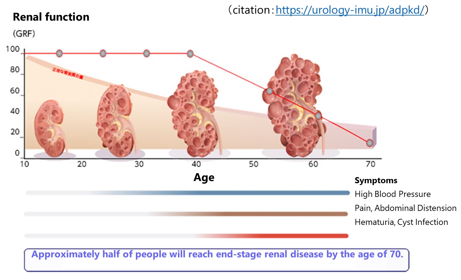 Rege Nephro will soon begin a clinical trial for autosomal dominant ...